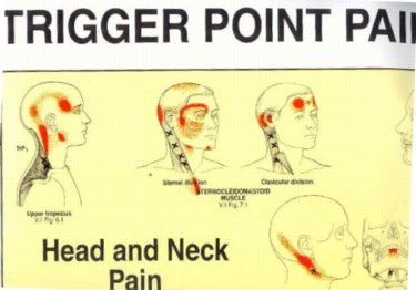 Campus Store : Trigger Point Pain Pattern Charts. Two Laminated Charts ...