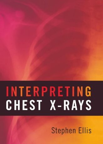 Matthews MUSC Bookstore : Interpreting Chest X-Rays