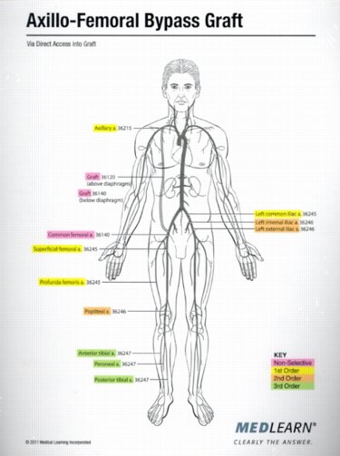Matthews MUSC Bookstore : Interventional Radiology Coding Charts 2012 ...