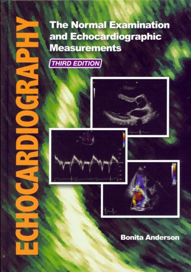 MatthewsBooks.com - 9780992322212 (0992322219) : Echocardiography: The ...