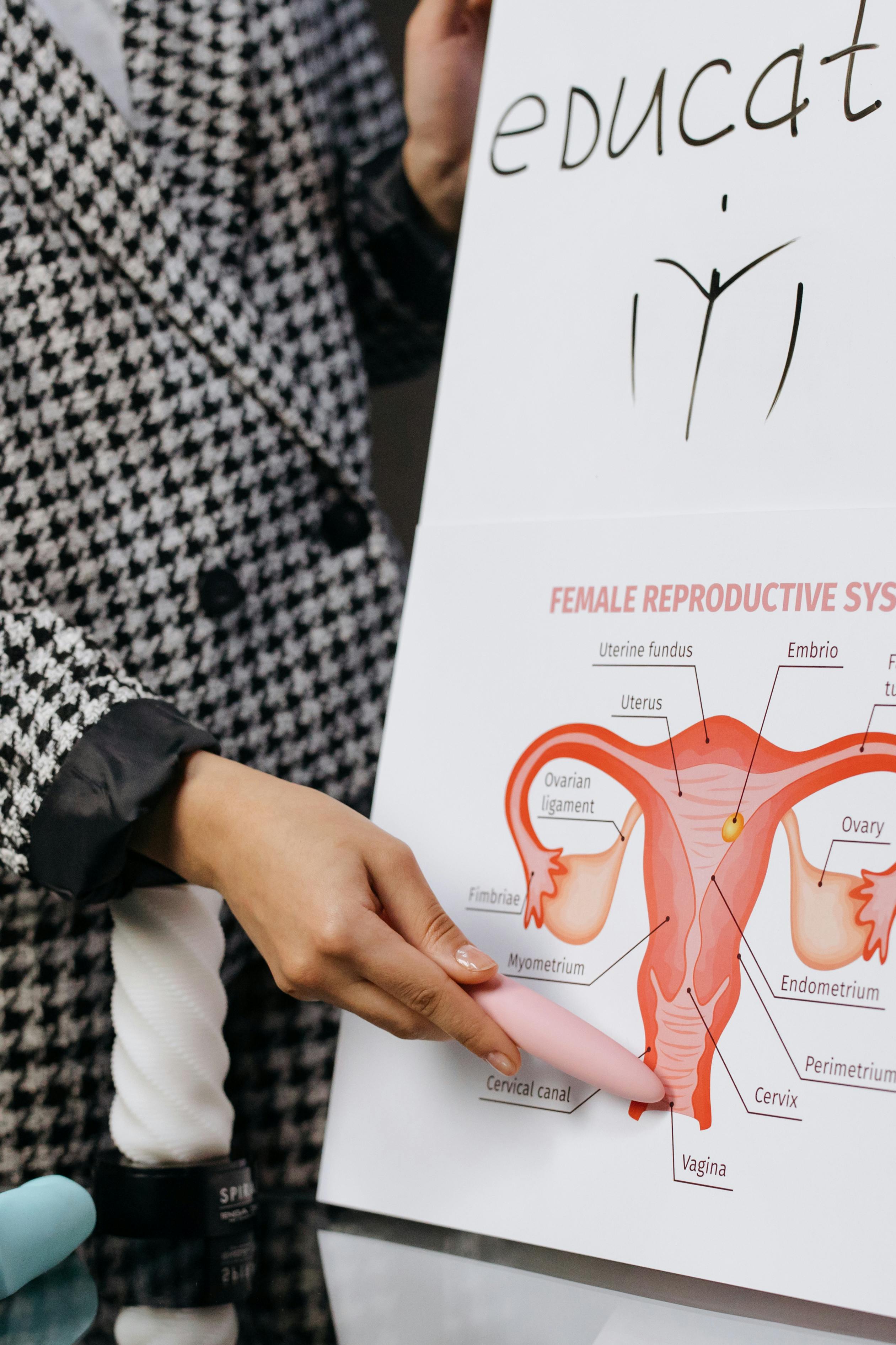 PCOS: the Hormone Disorder Every Teen Girl Should Know About