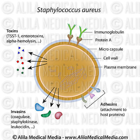 Alila Medical Media | Staphylococcus aureus bacterium | Medical ...