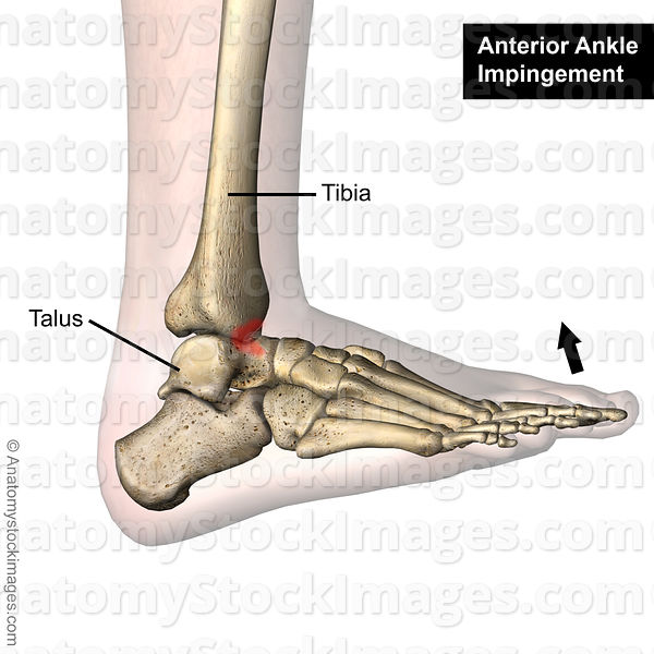 Anatomy Stock Images | ankle-anterior-impingement-bones-tibia-talus ...