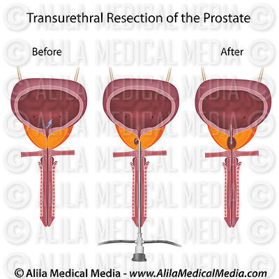 Alila Medical Media | Surgery Images & Videos