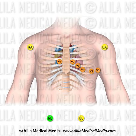 Alila Medical Media | Placement of electrodes for 12-lead ECG | Medical ...
