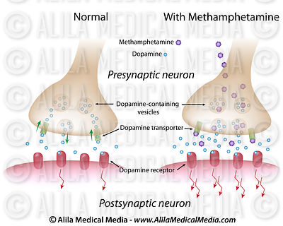 Alila Medical Media | Brain and Nervous System Images