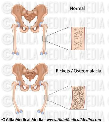 Alila Medical Media | Orthopaedics & Sport Medicine Images & Videos