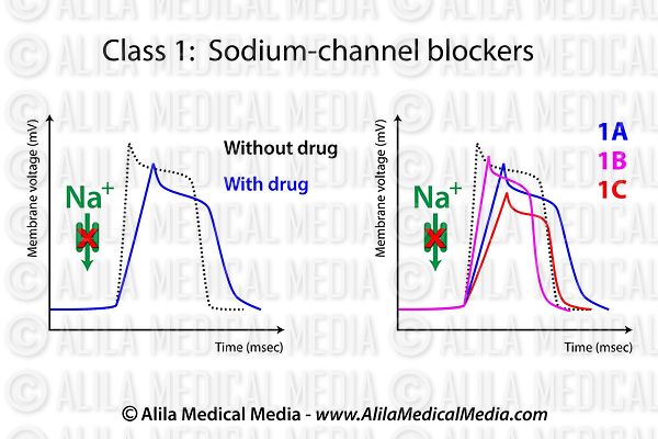 Alila Medical Media | Action of sodium-channel blockers | Medical ...