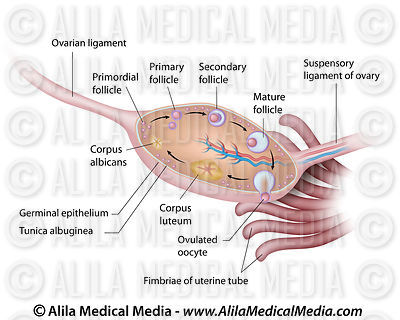 Alila Medical Media | Normal ovary and Polycystic ovary syndrome ...
