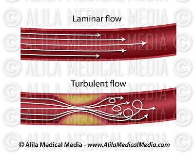 Alila Medical Media | Cardiology and Vascular Diseases Images & Videos