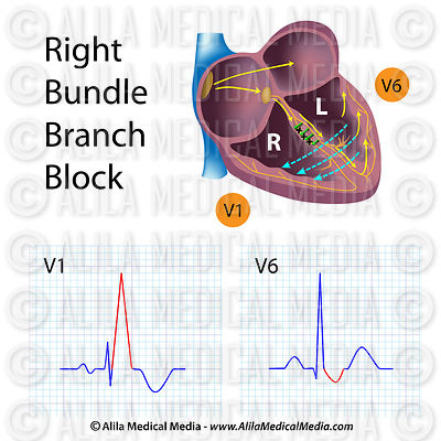 Alila Medical Media | Sinus rhythms ecgs | Medical illustration
