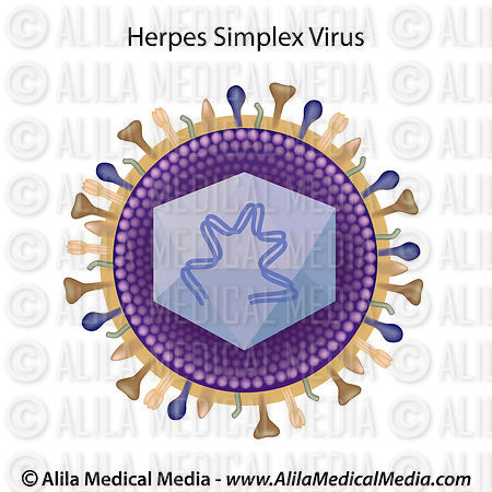 Alila Medical Media | Herpes simplex virus, unlabeled. | Medical ...