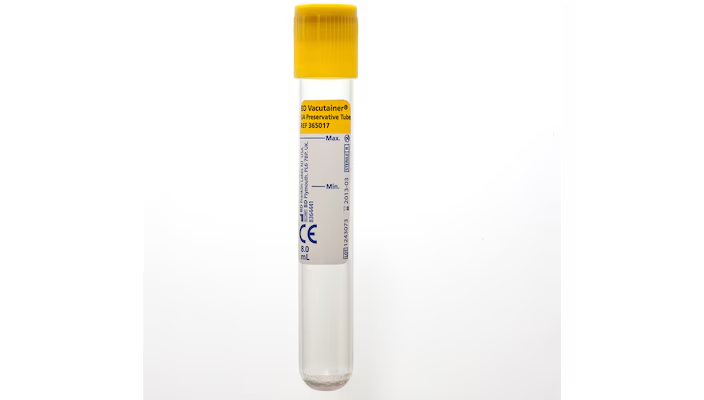 Urine Collection Tube 8ml with preservative| MEDISECUR - MediSecur