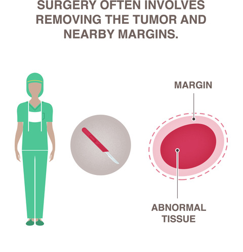 Surgery - National Breast Cancer Foundation