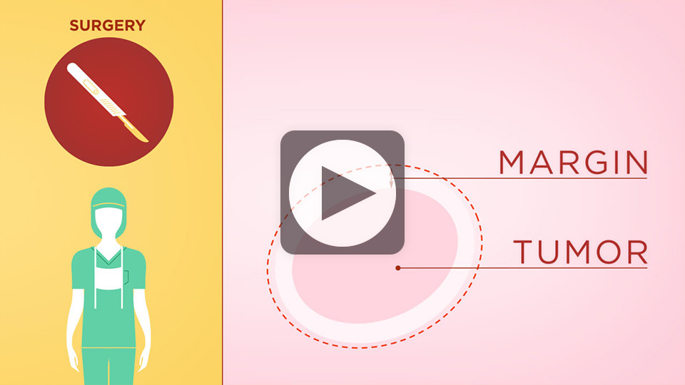 Surgery - National Breast Cancer Foundation