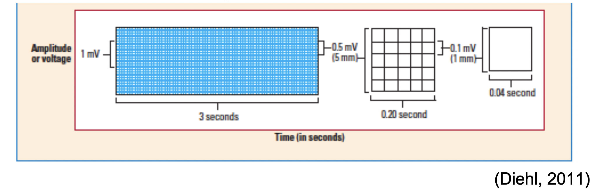 Introduction to Telemetry Monitoring for Arrhythmias Nursing CE Course ...