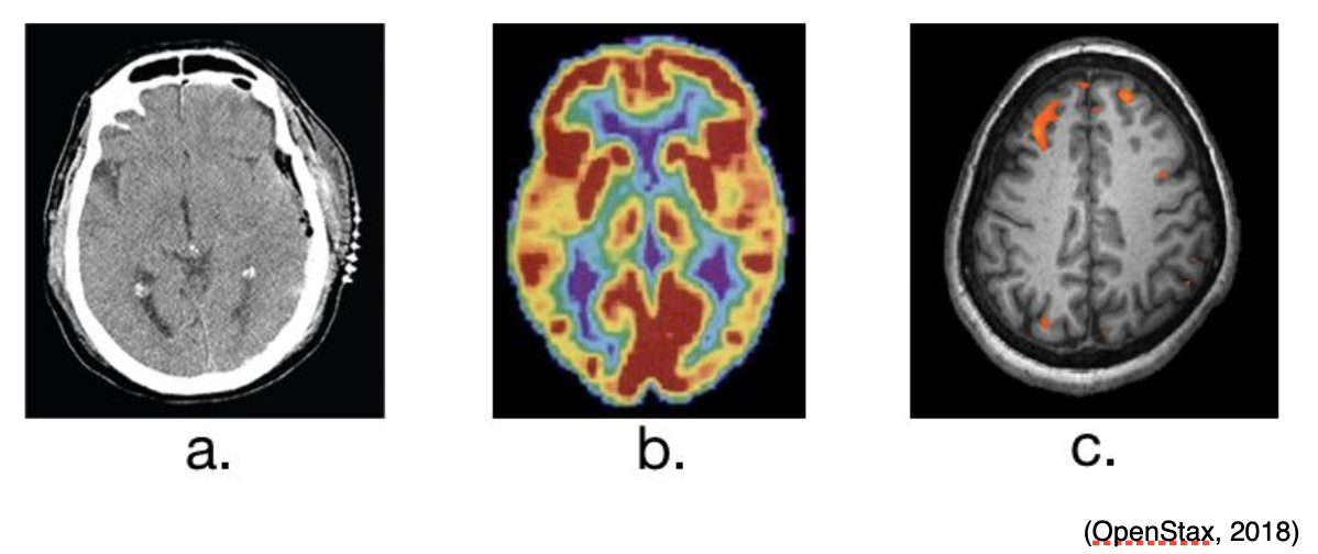 Seizures and Epilepsy for APRNs Nursing CE Course | NursingCE