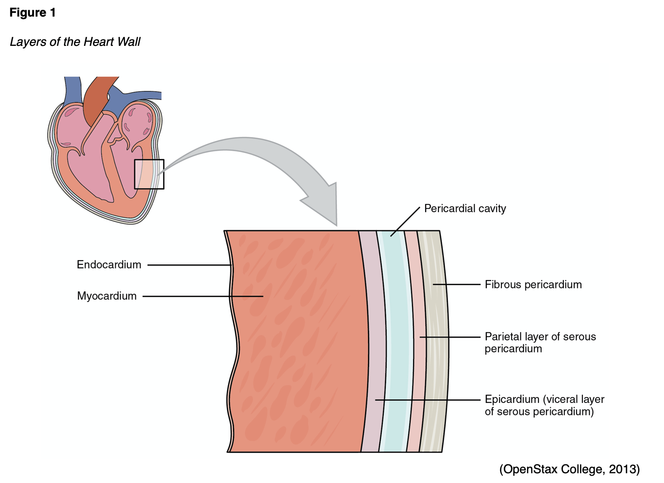 Myocardial Infarction