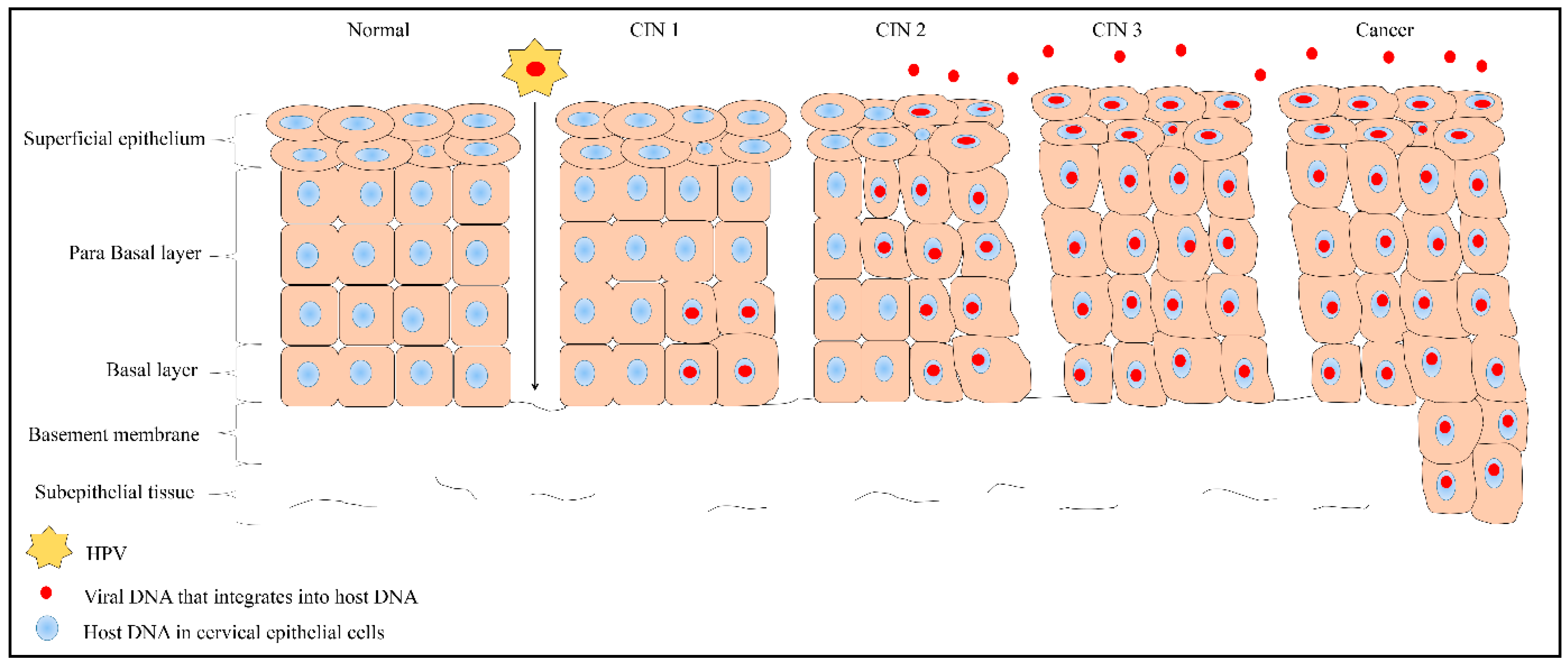 Cervical Cancer for APRNs Nursing CE Course | NursingCE