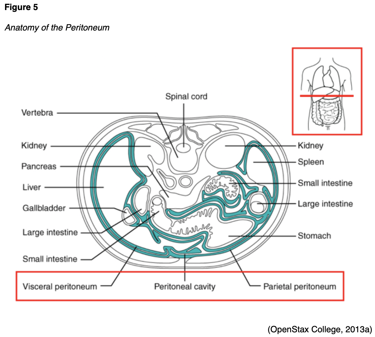 Ovarian Cancer for APRNs Nursing CE Course | NursingCE