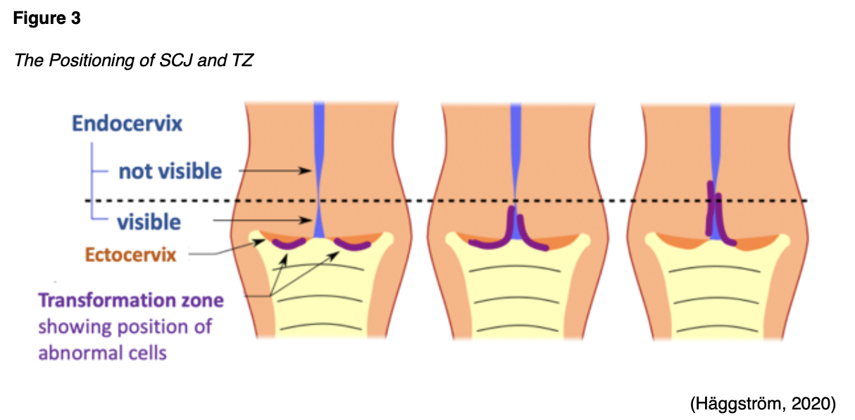 Cervical Cancer for RNs and LPNs Nursing CE Course | NursingCE