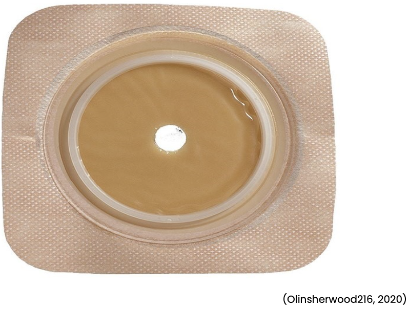 Ostomy Placement and Care Nursing CE Course | NursingCE