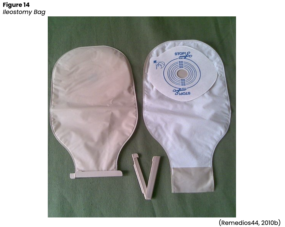 Ostomy Placement and Care Nursing CE Course | NursingCE