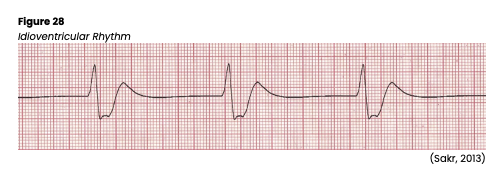 Introduction to Telemetry Monitoring for Arrhythmias Nursing CE Course ...