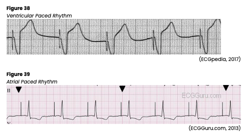 Introduction to Telemetry Monitoring for Arrhythmias Nursing CE Course ...