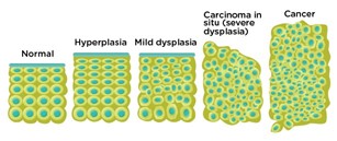 Oncology Medication Administration Nursing CE Course for RNs and LPNs ...