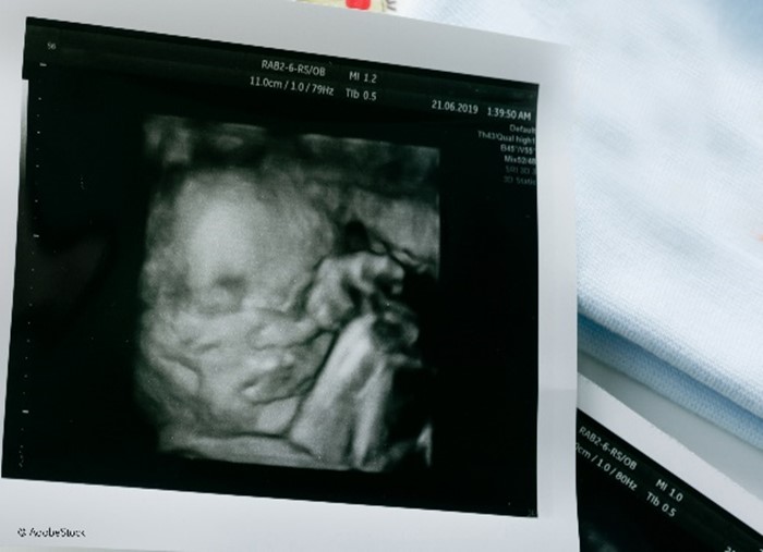 Diagnostic Radiology Nursing Ce Course For Rns And Lpns Nursingce