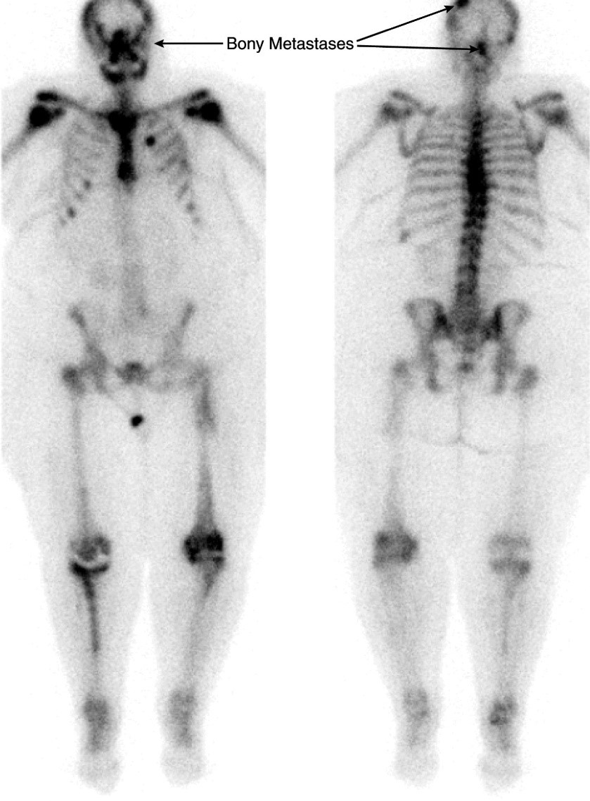 Diagnostic Radiology Nursing CE Course for RNs and LPNs | NursingCE