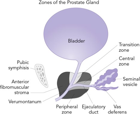 Prostate Cancer Nursing CE Course | NursingCE