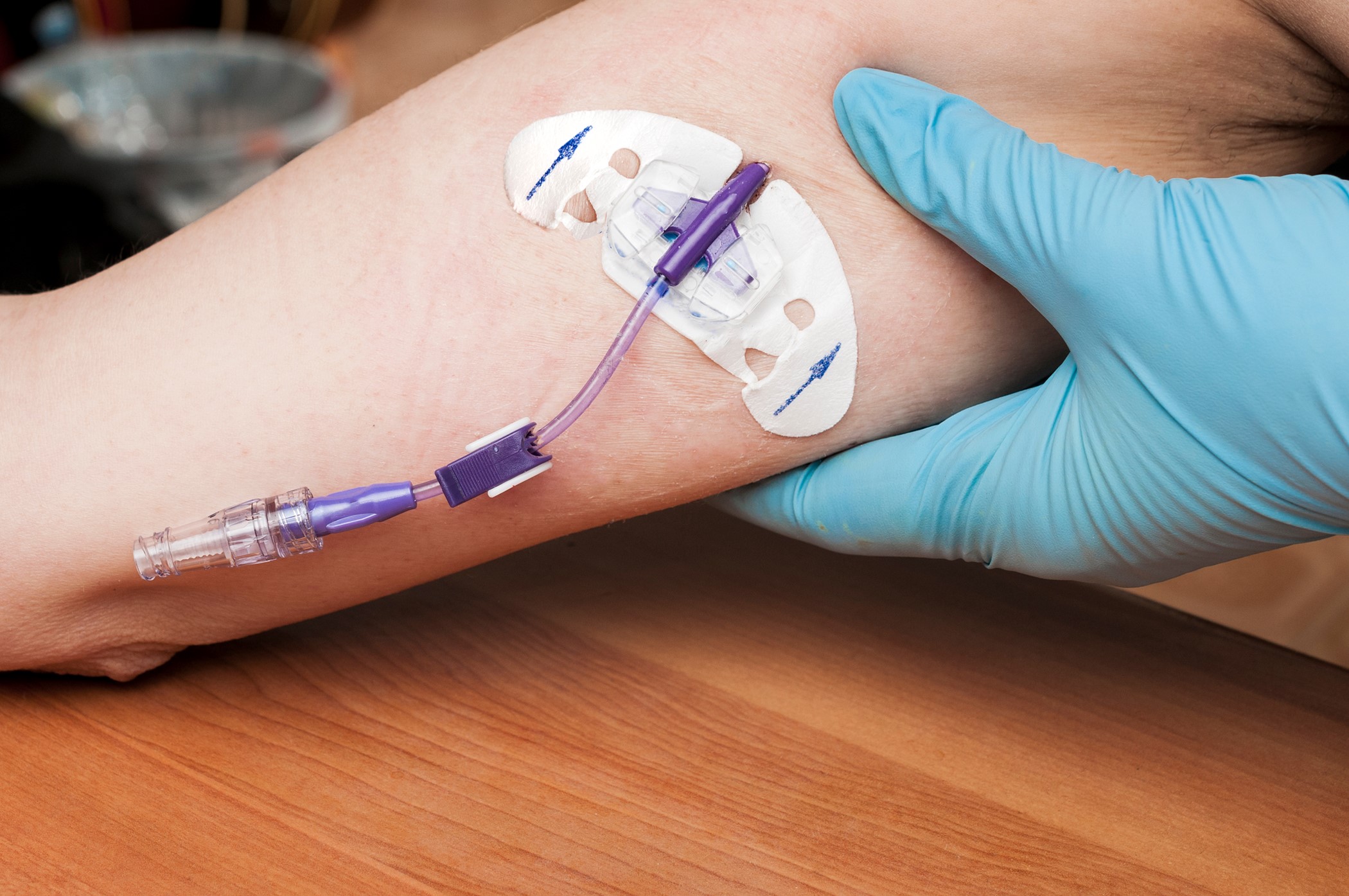 Vascular Access Devices Nursing CE Course | NursingCE