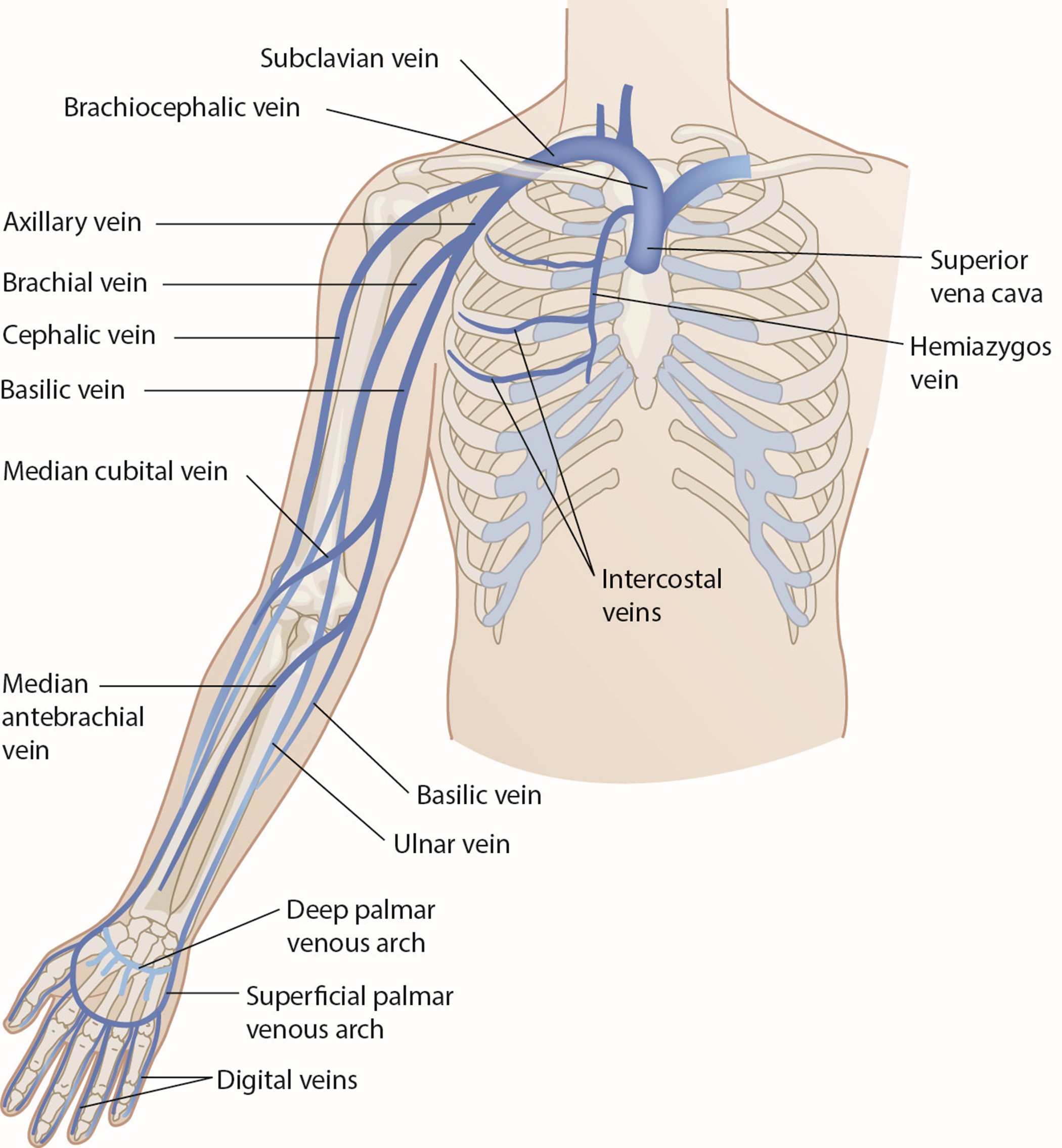 Axillary Vein Catheterization