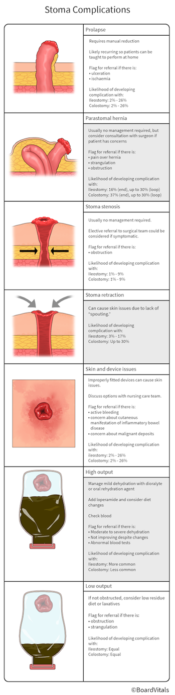Ostomy Placement and Care Nursing CE Course | NursingCE