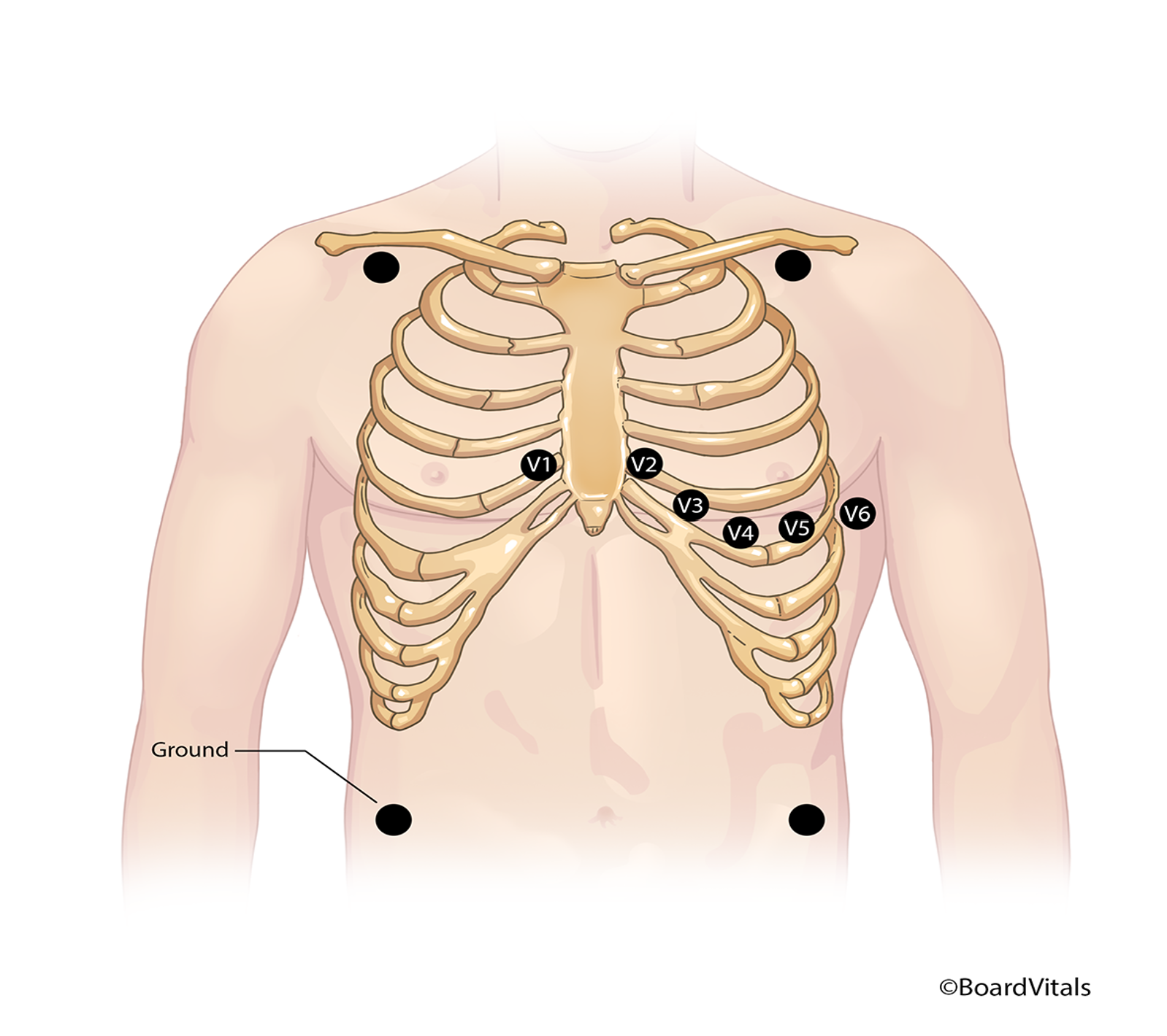 Introduction to Telemetry Monitoring for Arrhythmias Nursing CE Course ...