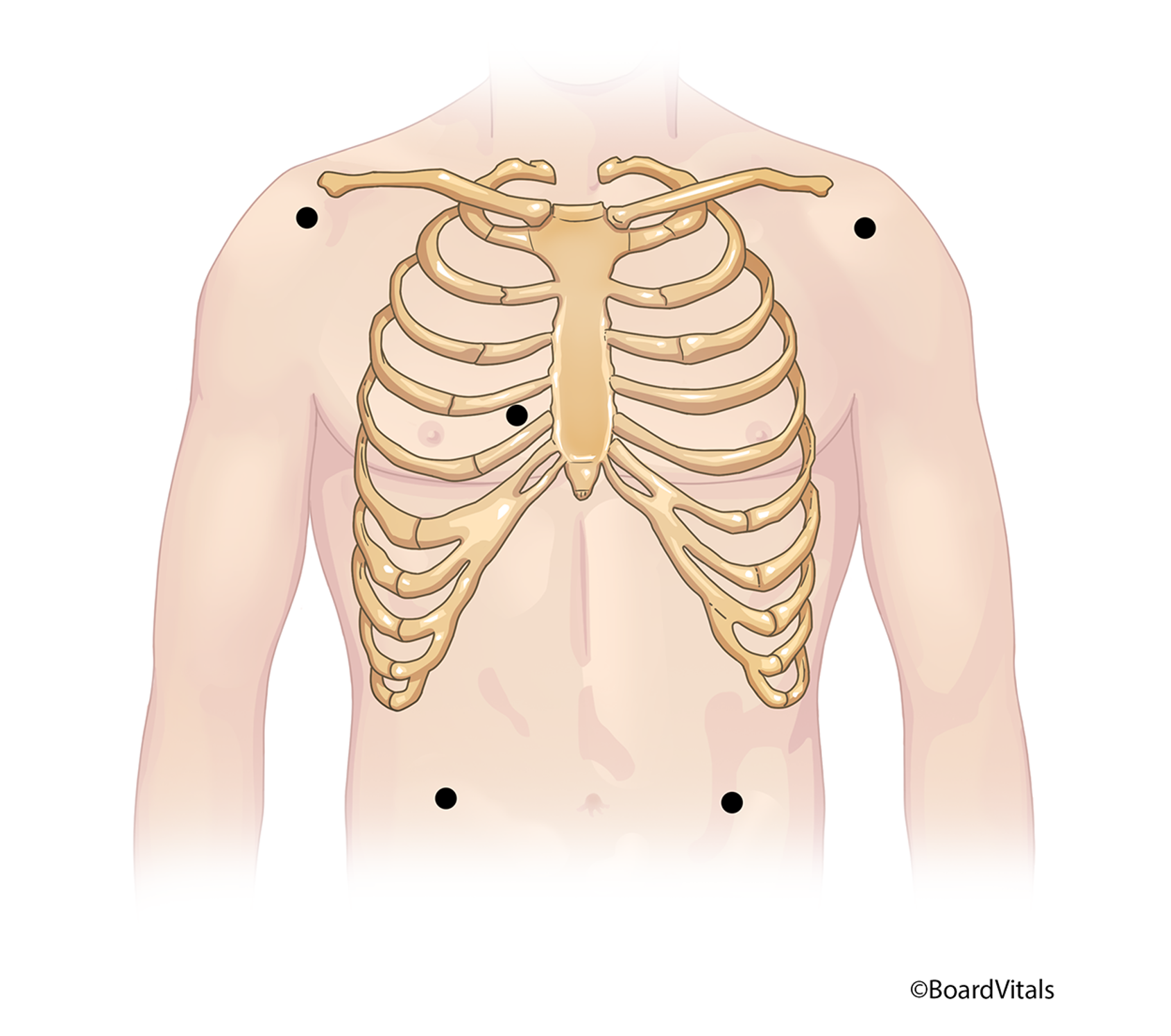 Introduction to Telemetry Monitoring for Arrhythmias Nursing CE Course ...