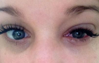 Permanent Eyelash Extensions Gone Wrong