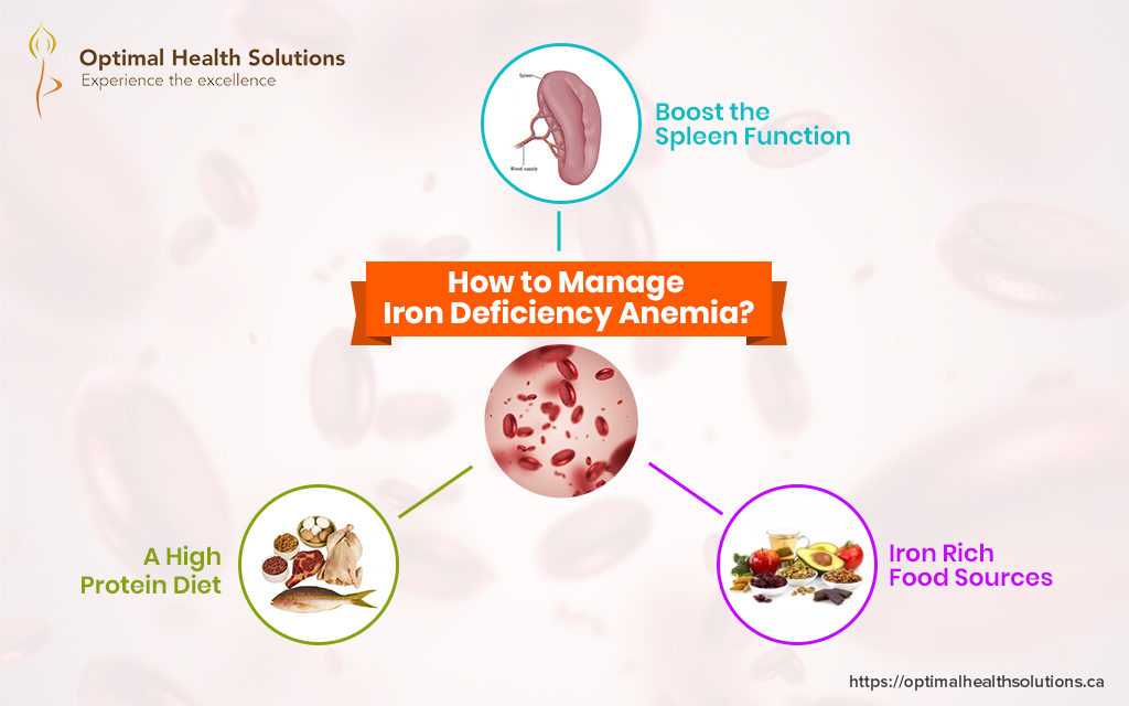 How to manage iron deficiency anemia
