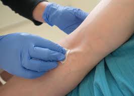 7 Tips for Reducing Injection Pain | PainScale