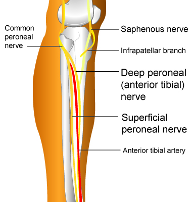 Regenerative Treatment For Common Peroneal Nerve Injuries