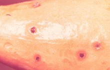 Gourd | Diseases and Pests, Description, Uses, Propagation