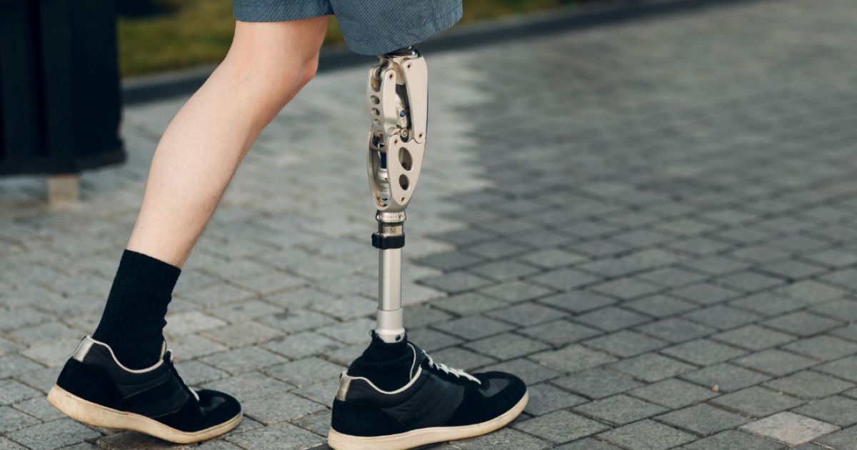 Por Dentro | Salud: Podrían sentir las prótesis como parte de sus cuerpos