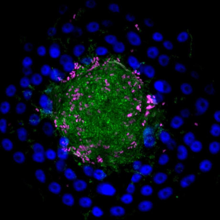 HCR-FISH for Choanoflagellate Cultures