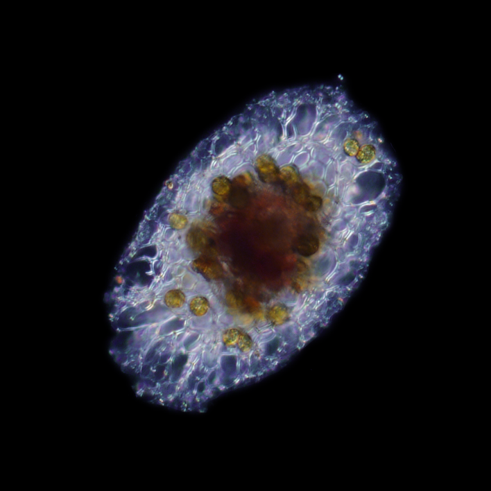 Single cell rDNA amplification of Spumellaria (Radiolaria)