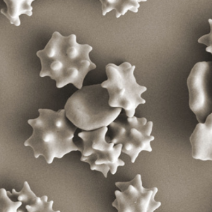 Preparation of human Red Blood Cells for Scanning Electron Microscopy ...