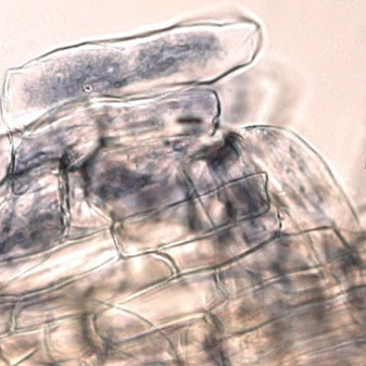 Semi-quantitative measure of roots colonization by arbuscular ...