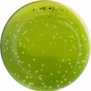 Chlorella Virus Plaque Assay