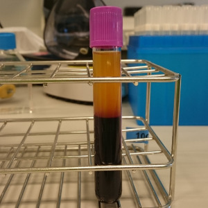 plasma preparation_test